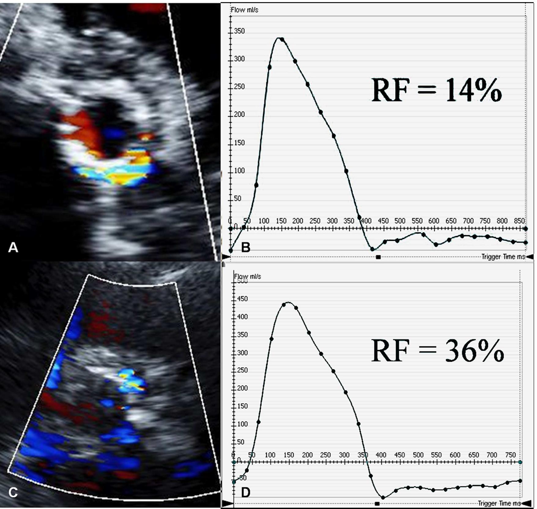 Examples of discrepancies between echocardiographic and