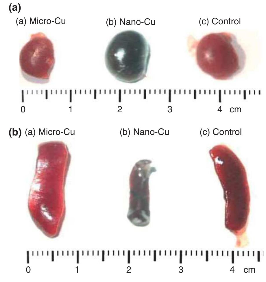 | (a) the appearance of mouse kidneys in various treatment