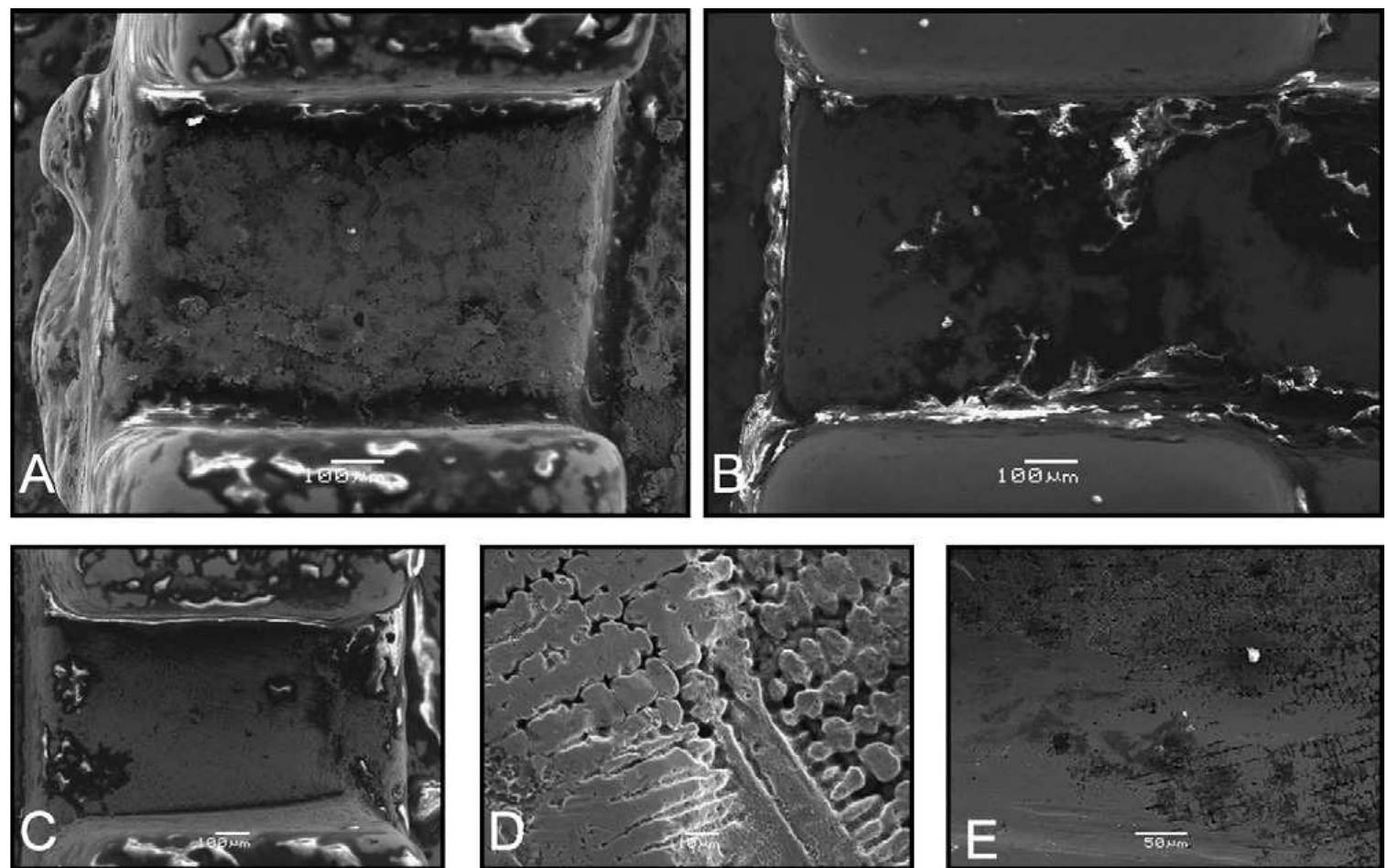 Scanning electron microscope images of nuedge brackets: a,