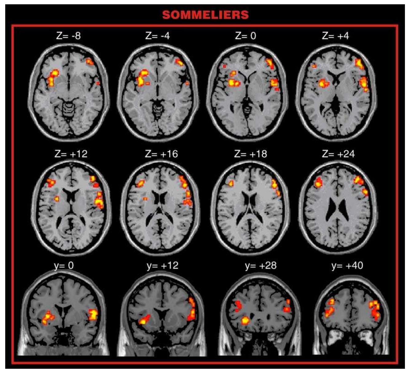 Simple main effects: sommeliers. brain areas more involved