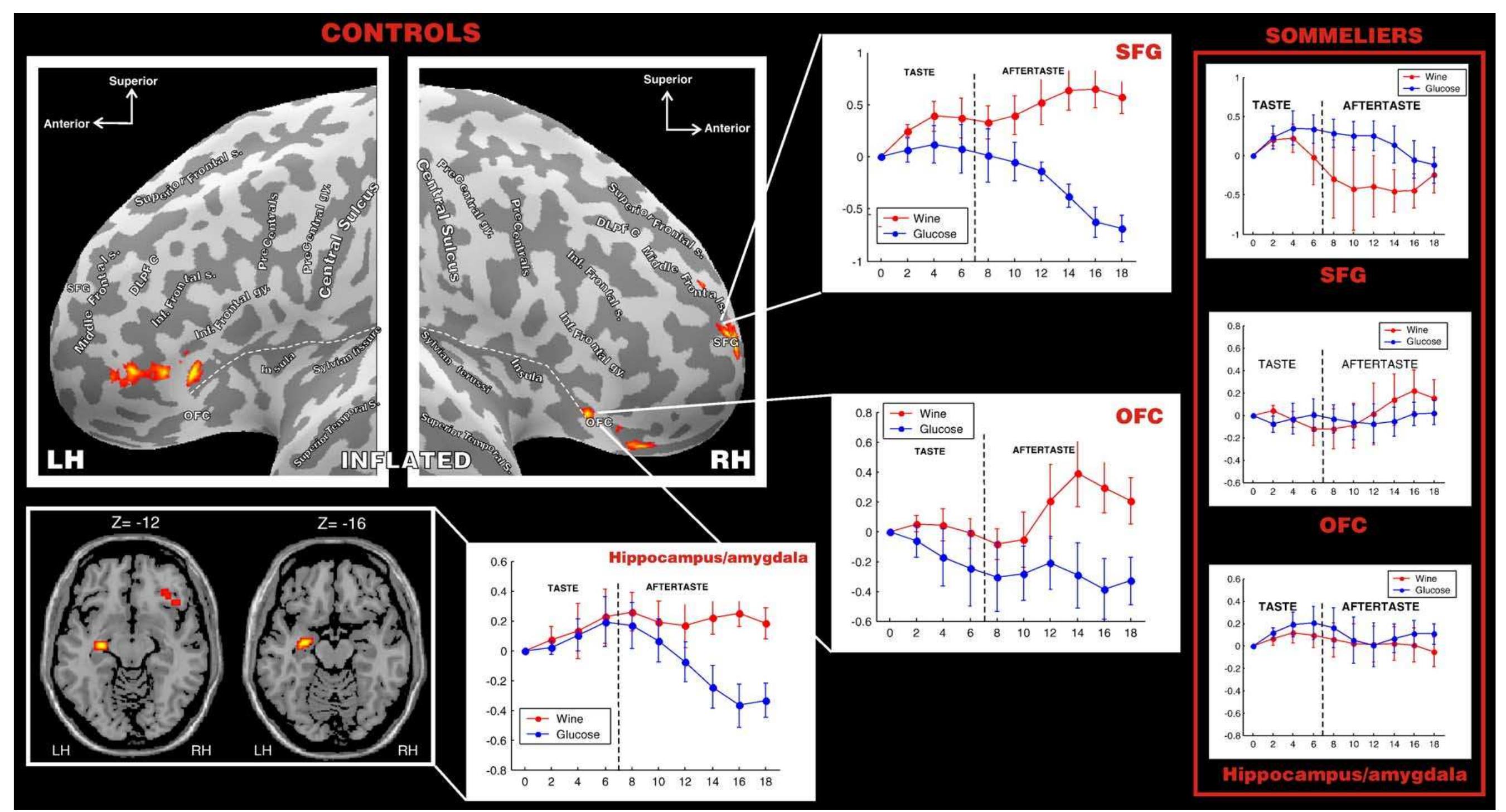 Interaction. brain areas more involved in the aftertaste