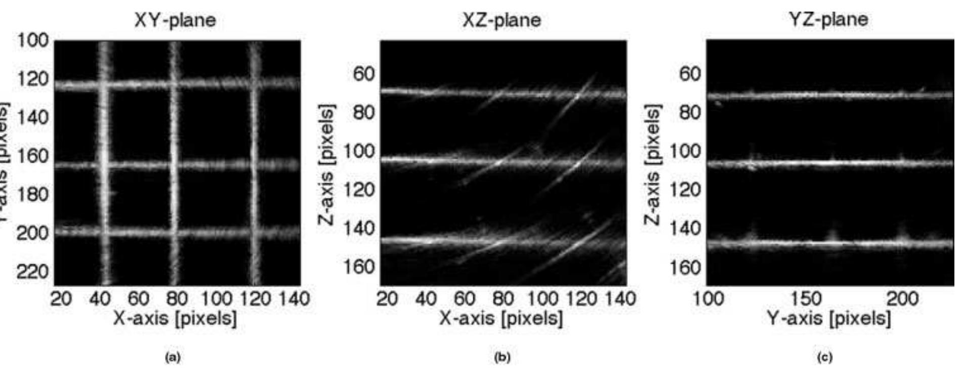 Sample ultrasound images (three orthogonal views) from a