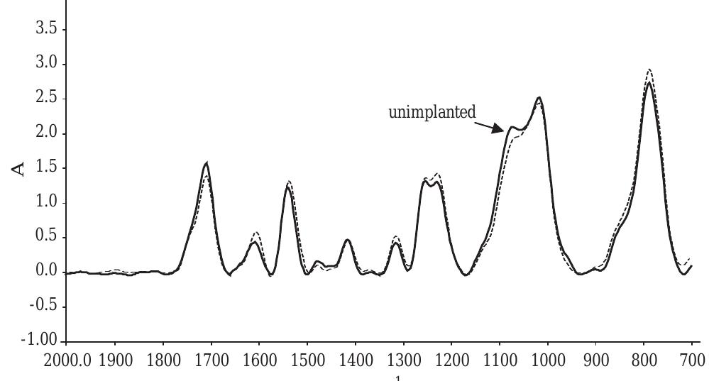 Atr-ftir spectrum for elast-eon™ 2 80a implanted for 24