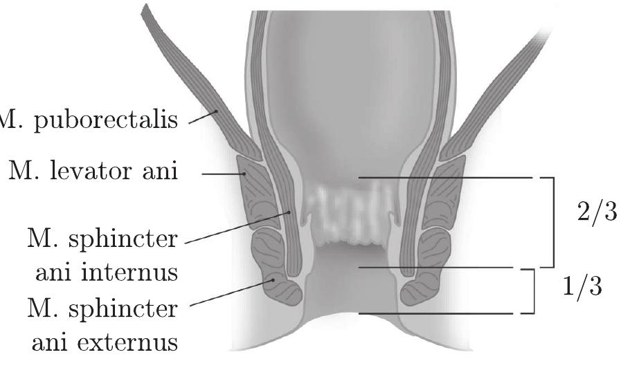 low perianal fistulas are fistulas where the fistula tract