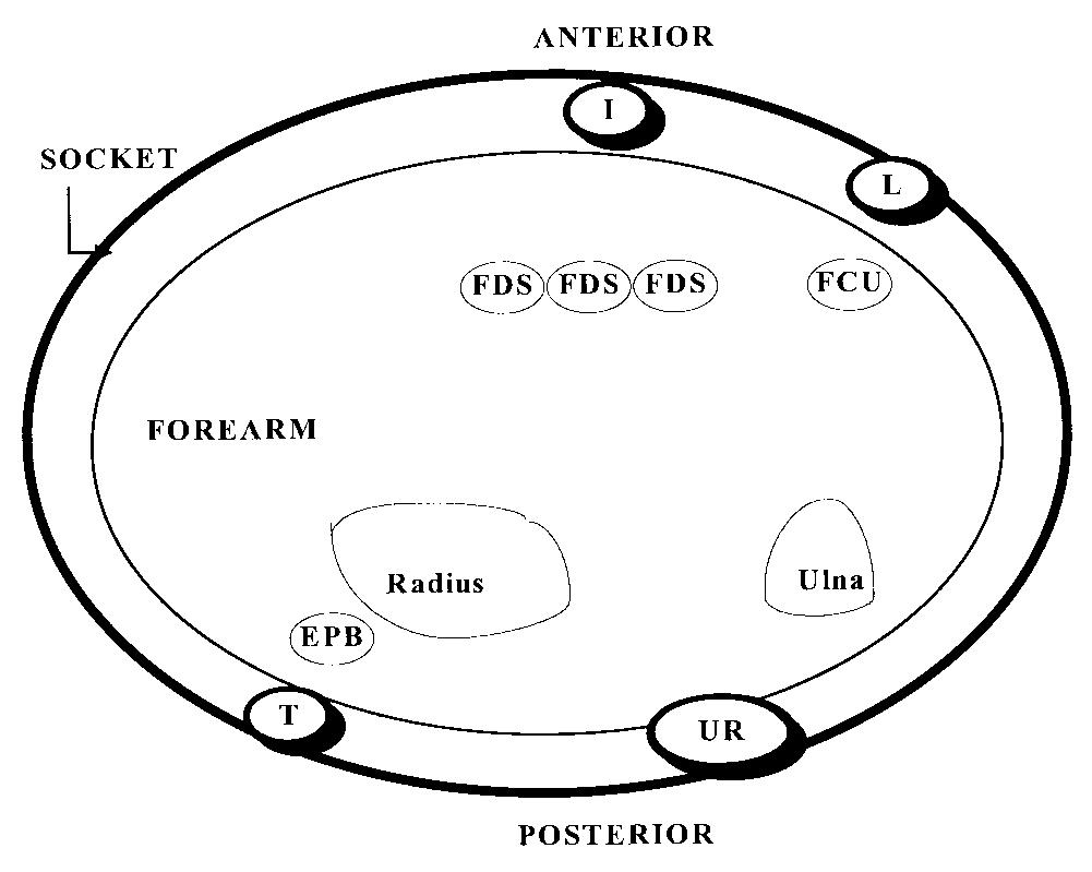 Cross section of anatomical sensor placement. targeted
