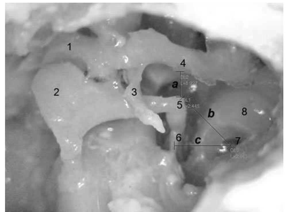 J malleus head, 2 incus body, 3 chorda tympany nerve, 4