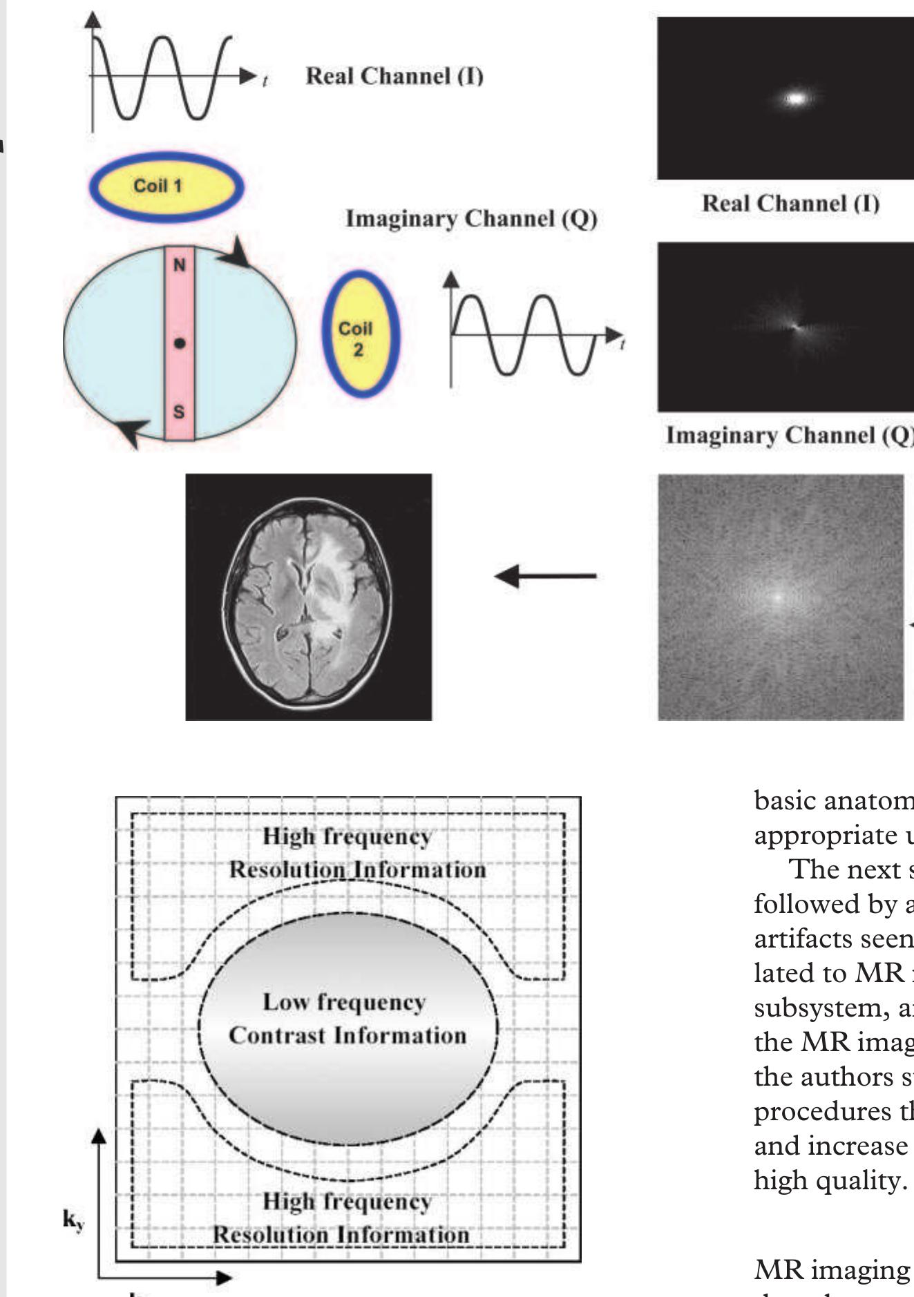 Schematic shows the location of low-frequency information