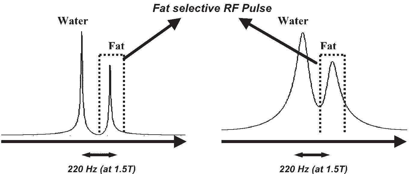Figure 15 - from AAPM/RSNA Physics Tutorial for Residents MR