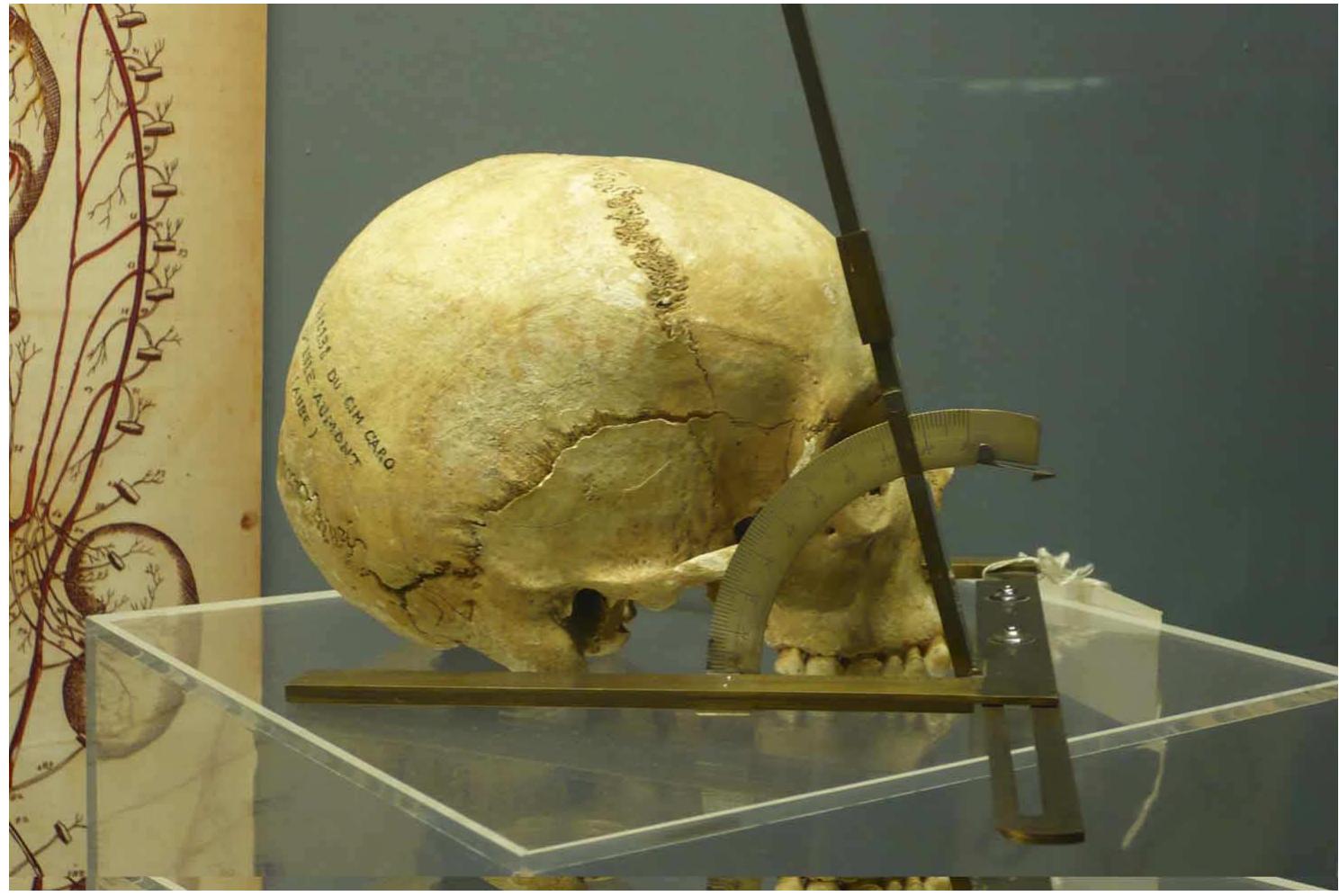 Figure 1 - Thinking with the Head: Race, craniometry,