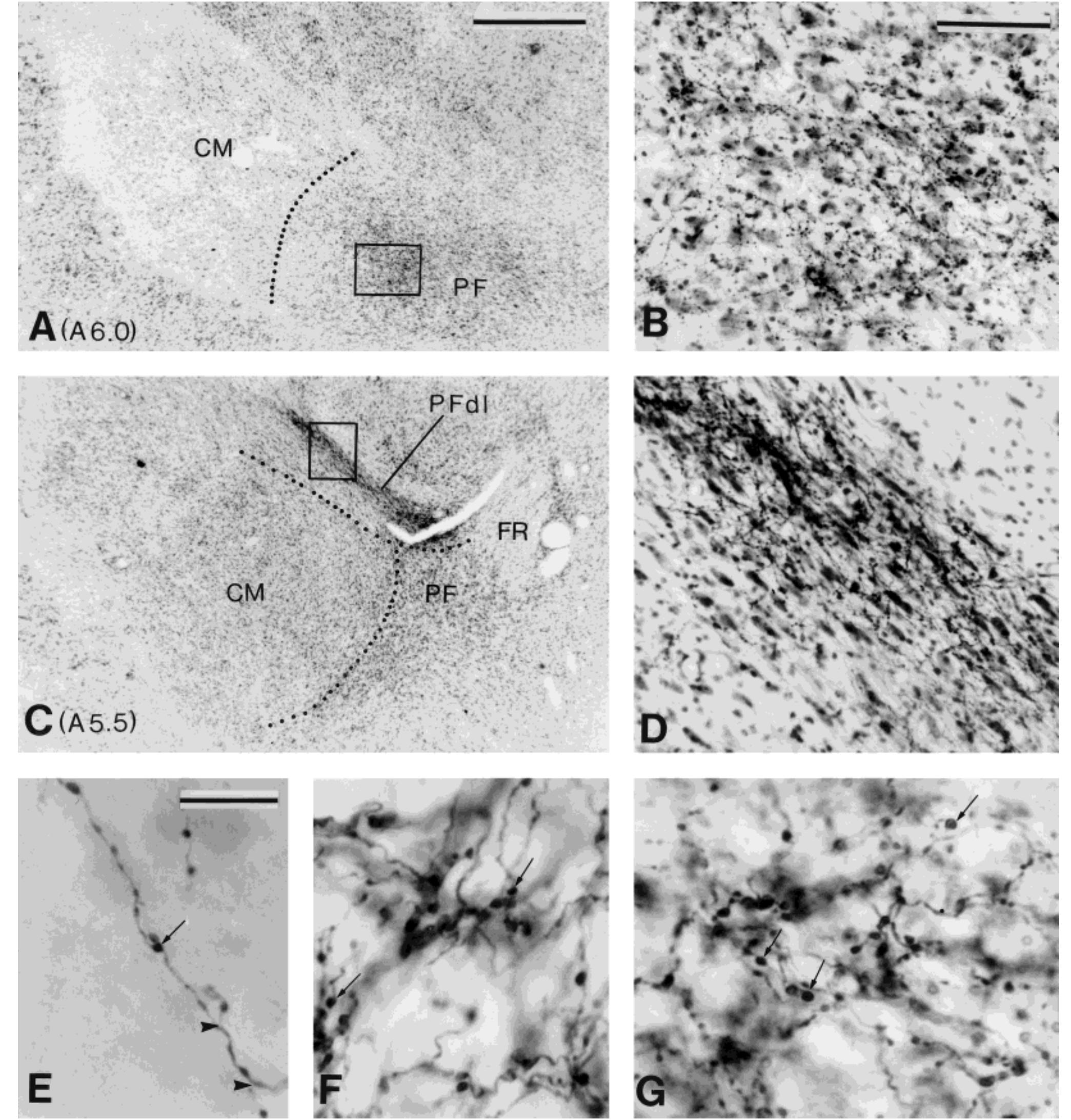 A-g: photomicrographs showing bda-labelled terminals in the