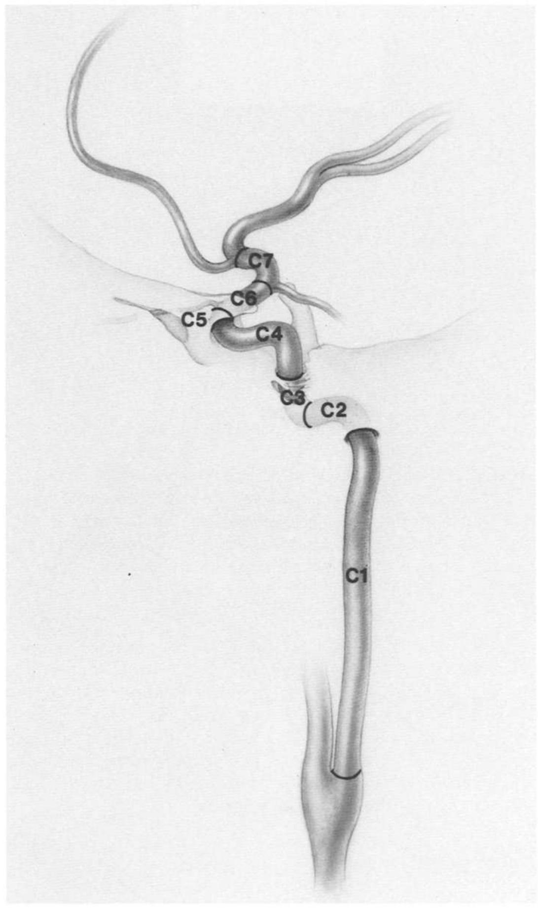 Segments of the internal carotid artery: cervical (c1),