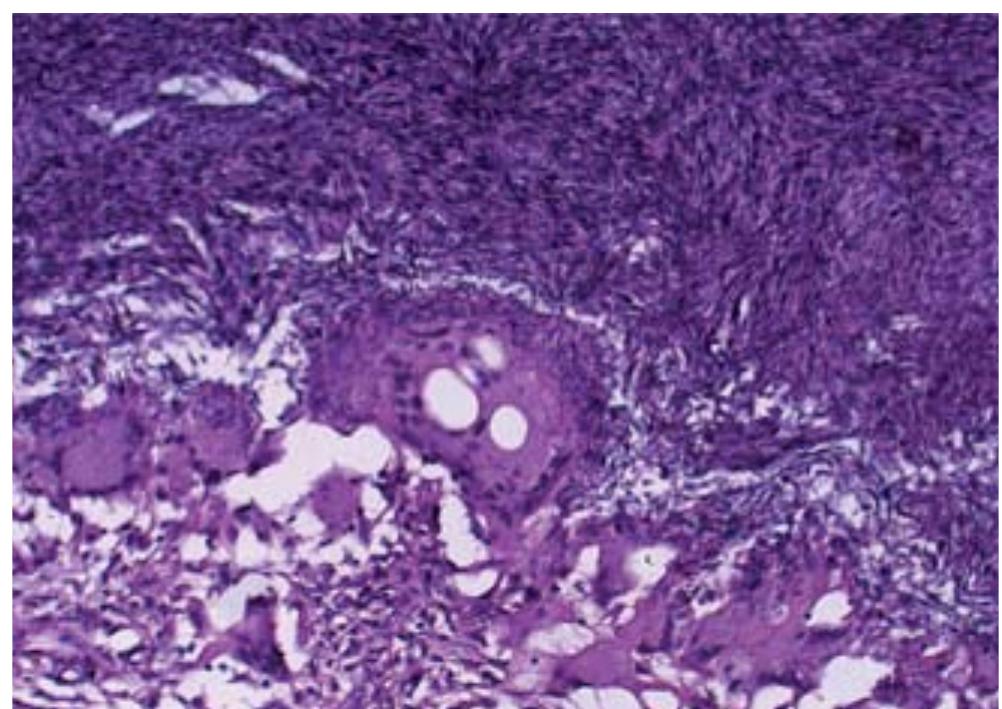Figure 7 - Pathogenesis and pathobiology of brucellosis in