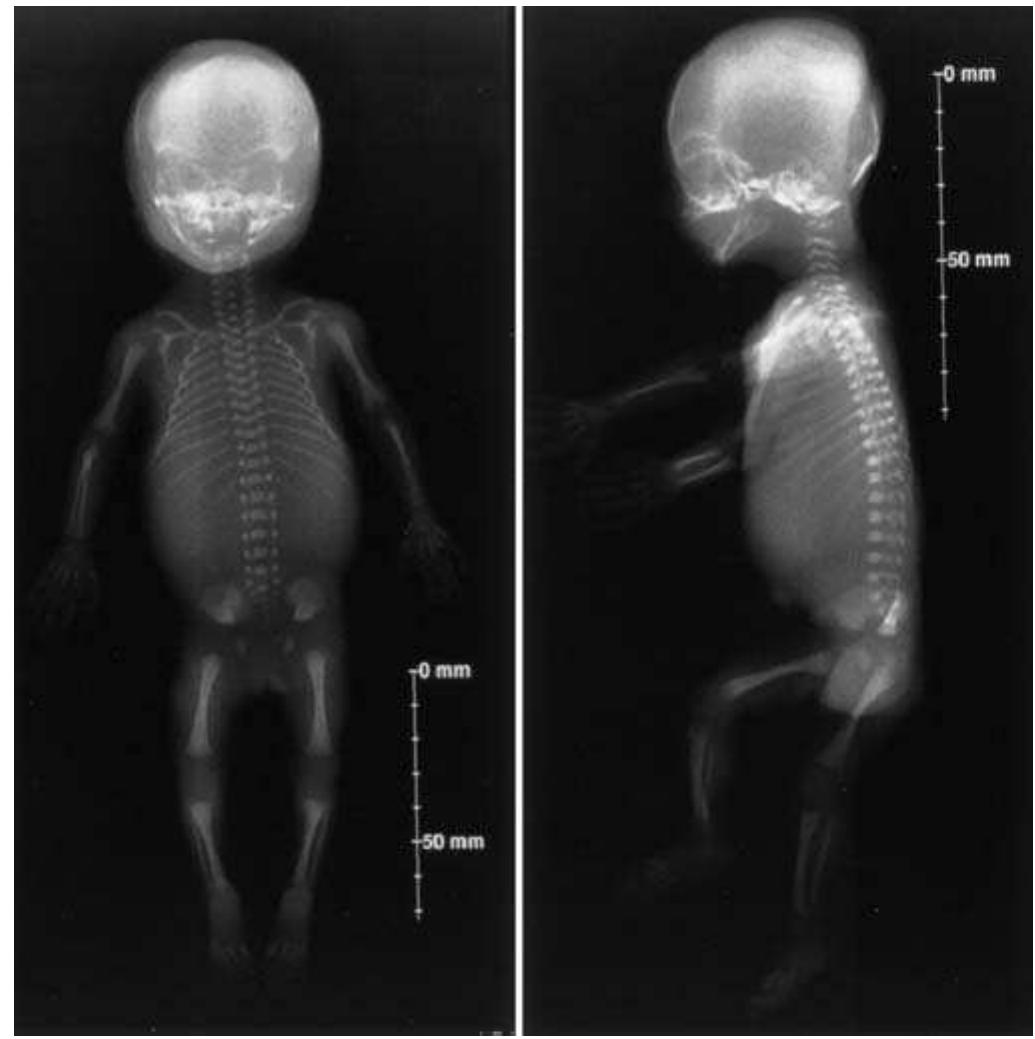 Face and lateral view of a normal male fetus with a gestat-