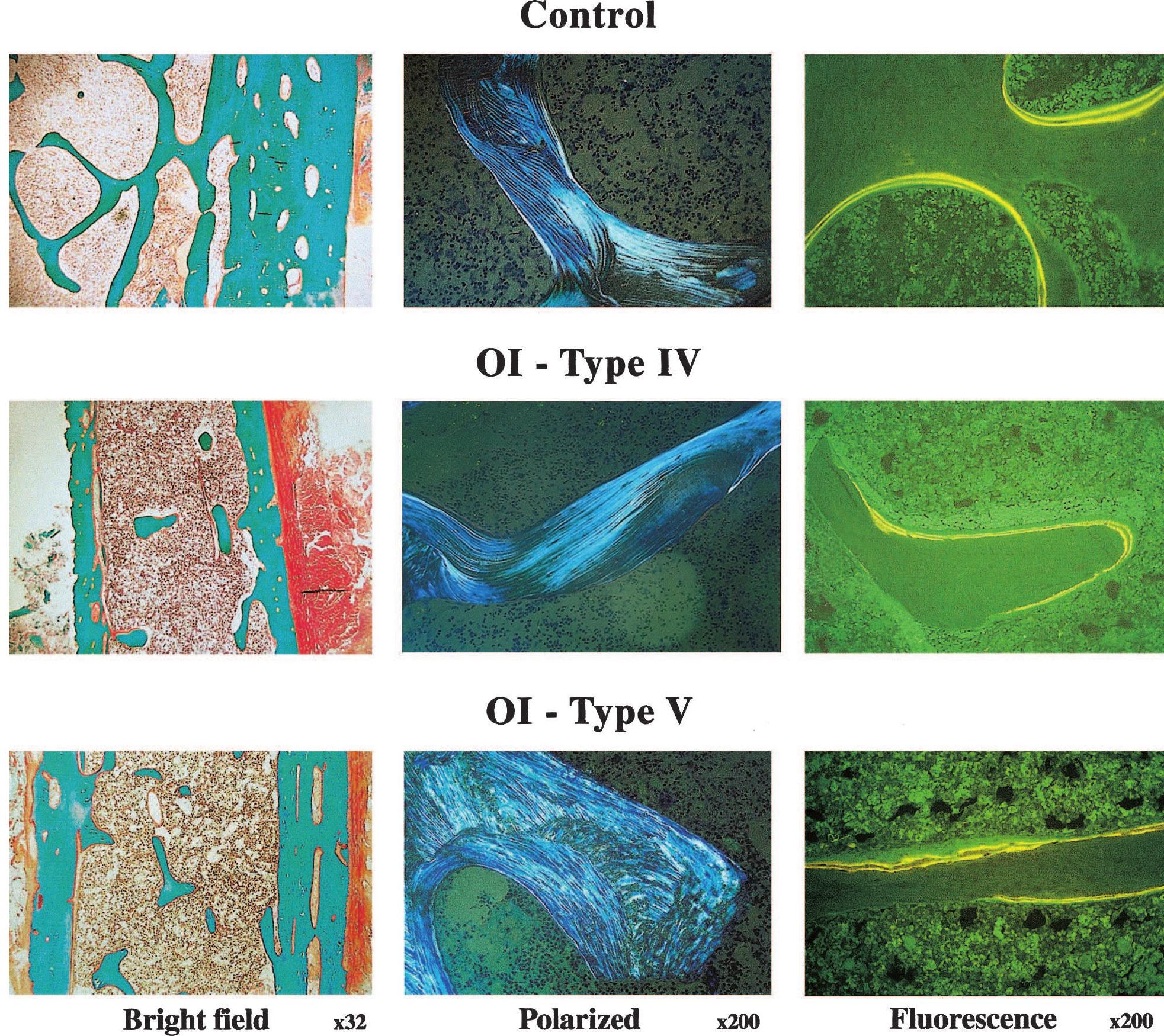 Histological appearance of iliac crest bone from a healthy