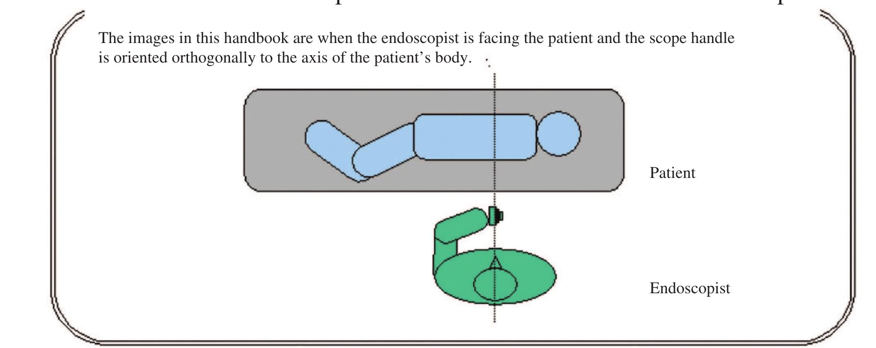 Standard scanning methods.