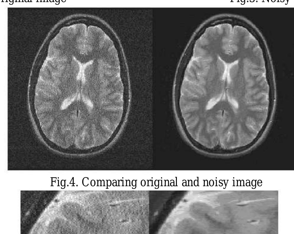Figure 9 Mri Image Reconstruction Using Non Linear