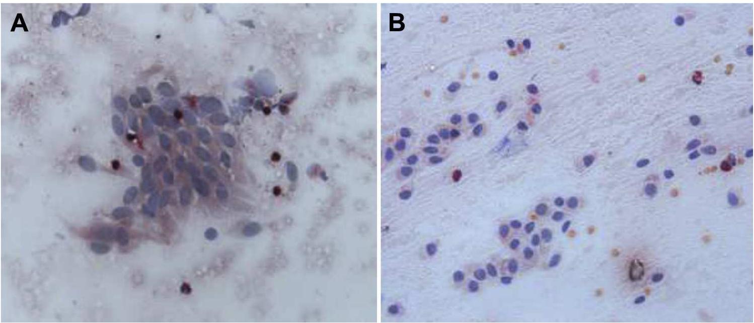 Ig. 6. cytology smears stained by ciae, observed by light
