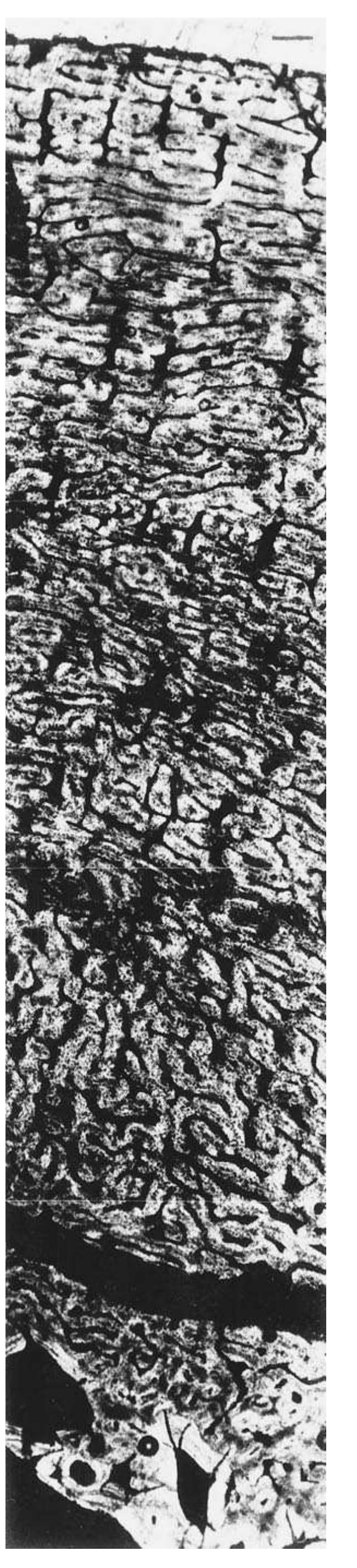 Figure 4 - Growth patterns deduced from the bone histology