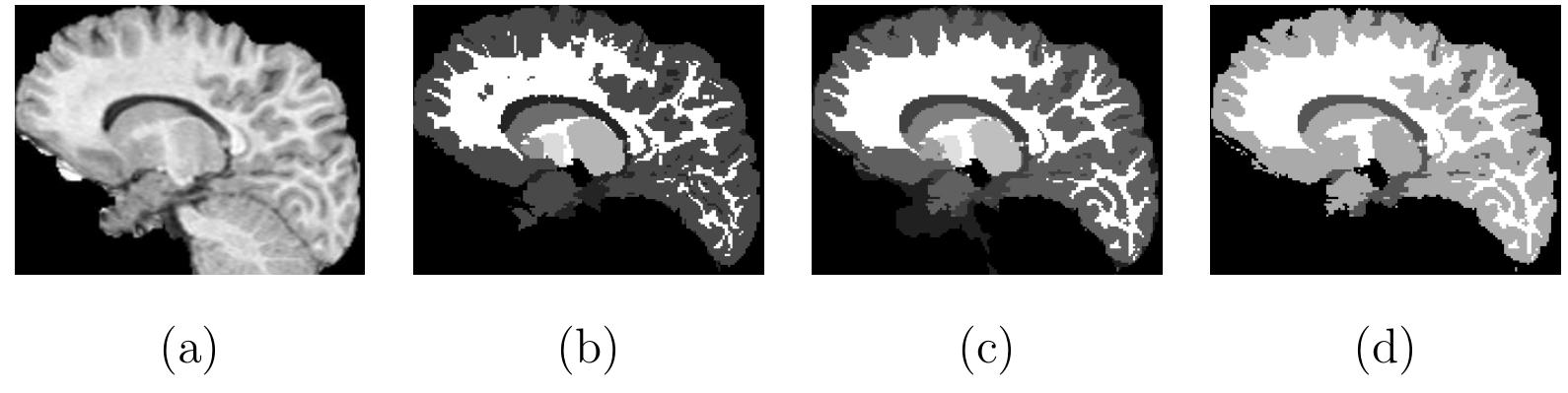 Figure 10 - Segmentation of Brain MRI in Young Children