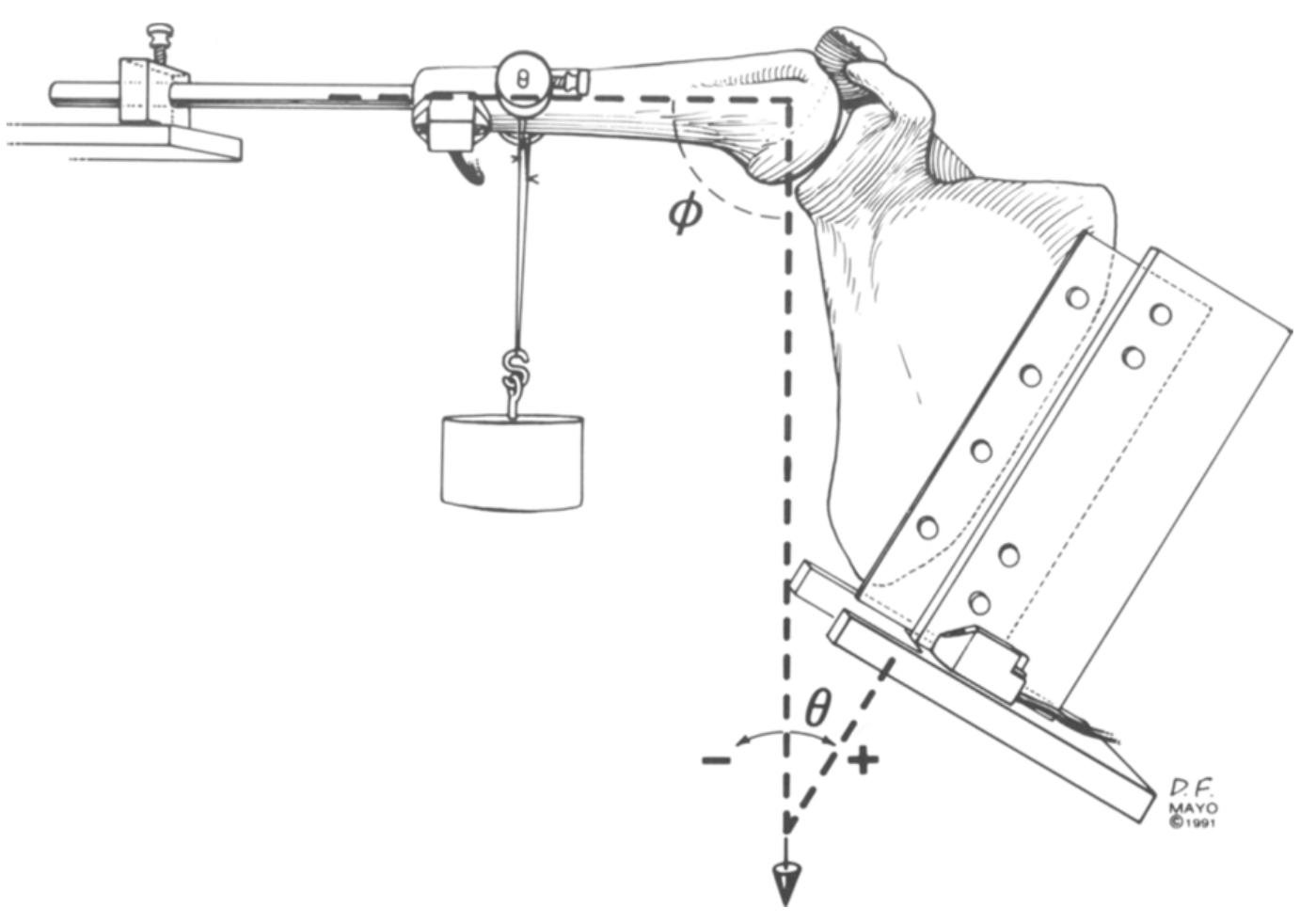 Schematic drawing of abis test. scapula is inclined 30° (6