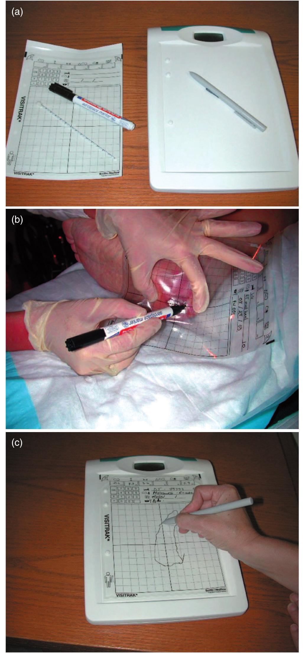 Visitrak™ system. (a) the visitrak™ system consists of a