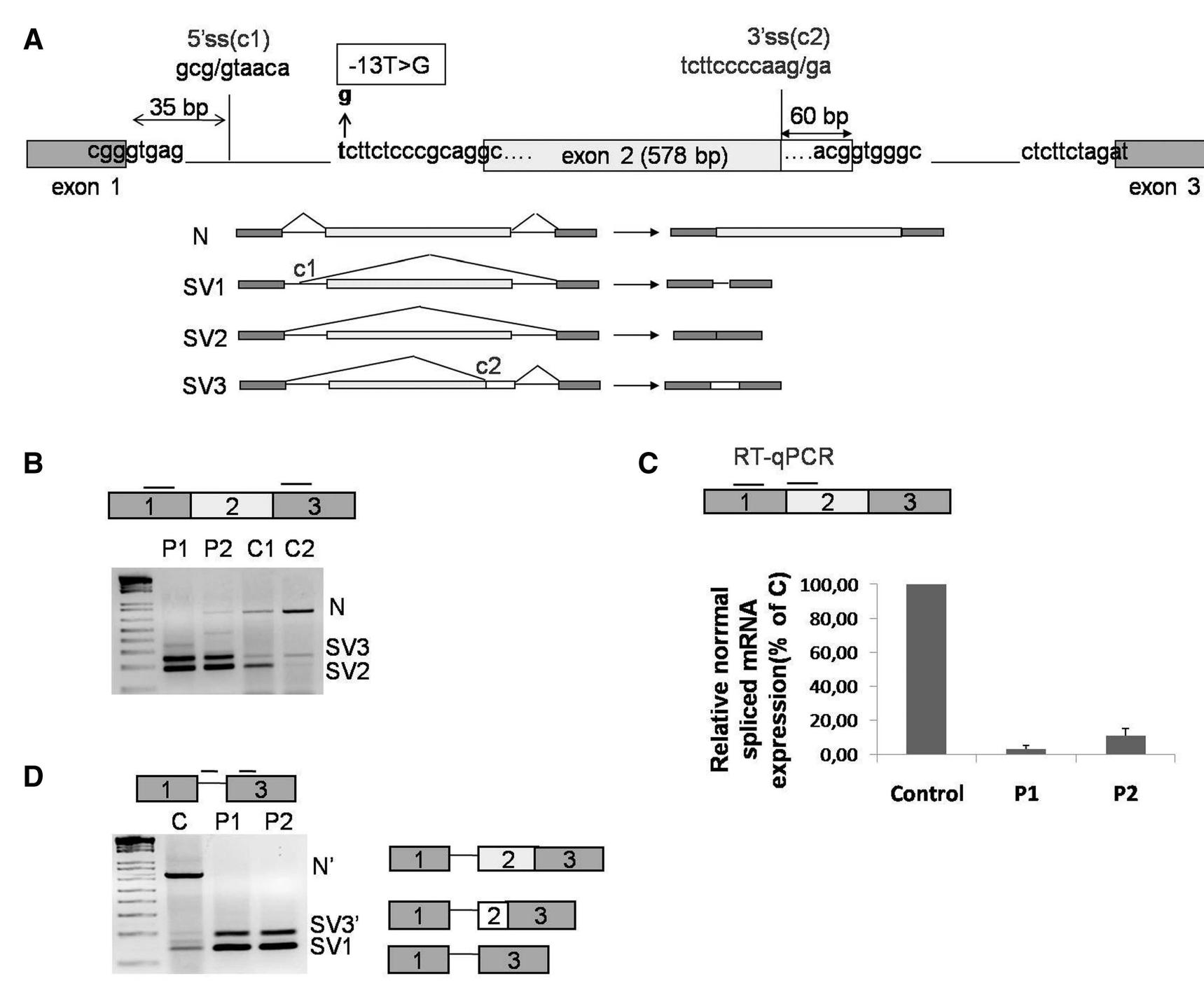 Gaa mrna splicing variants expressed in cultured