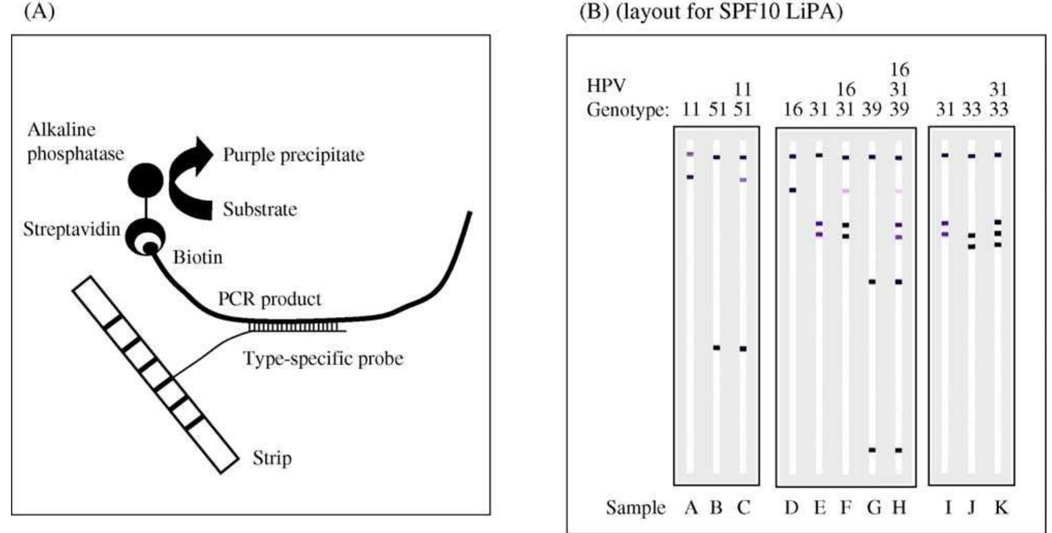 Outline and example of the reverse hybridization hpv line