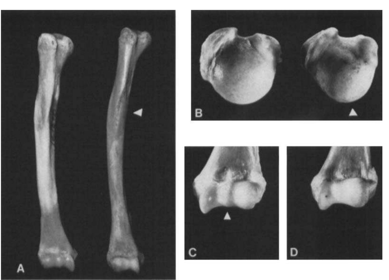 Humerus. anterior view of a right humerus (a), a superior