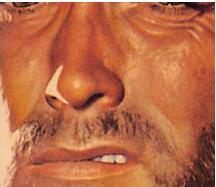 Contraction of the left levator labii superioris muscle