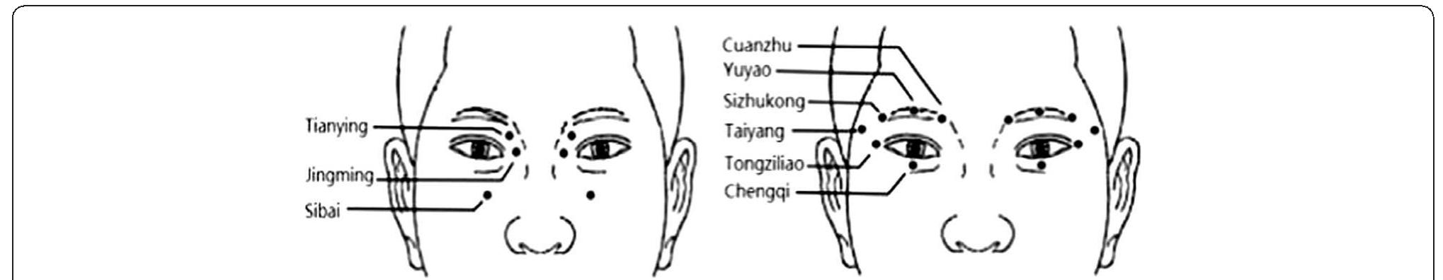 Schematic diagram showing the positions of the acupoints