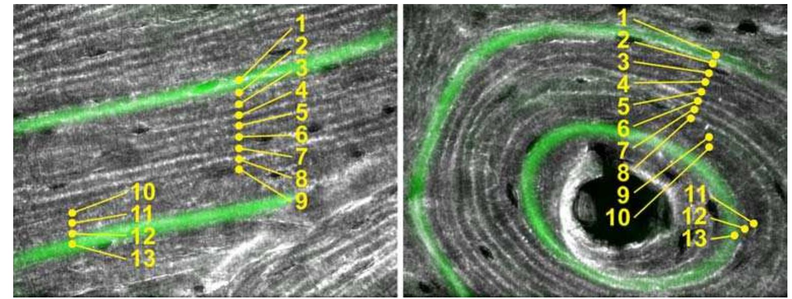 Primary and secondary osteonal lamellae from the midshaft