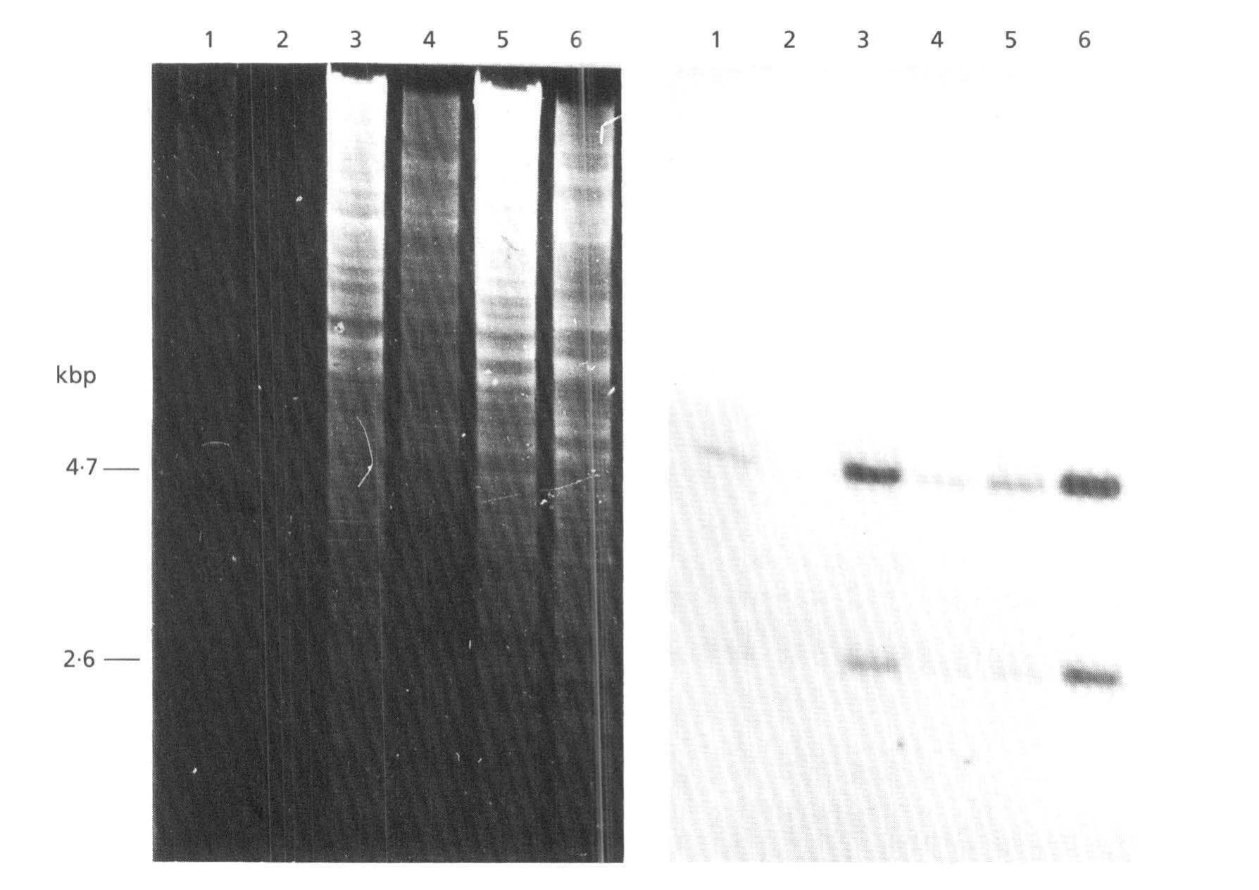 Agarose gel electrophoresis of genomic dna restriction