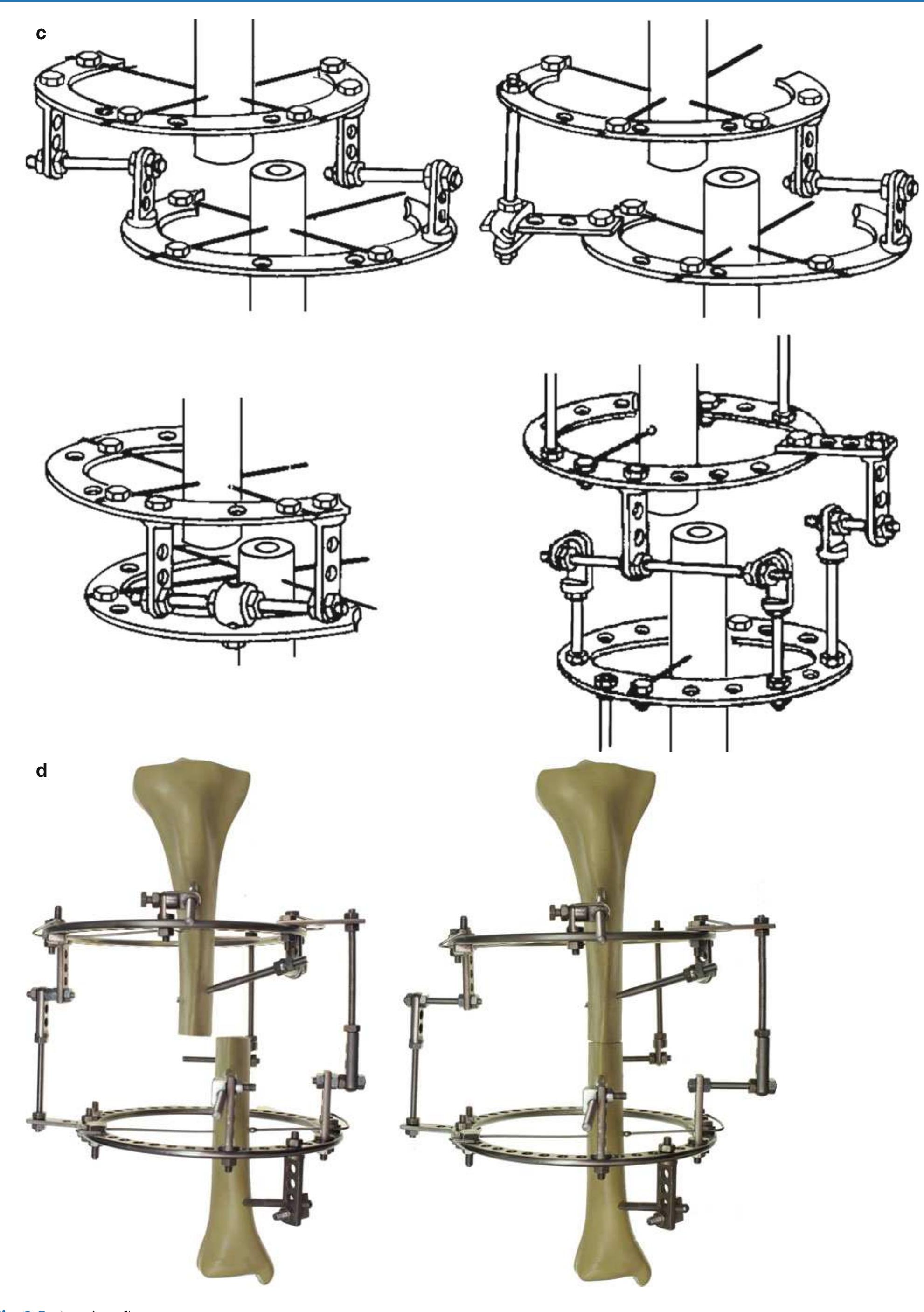 Figure 6 - Biomechanical Principles