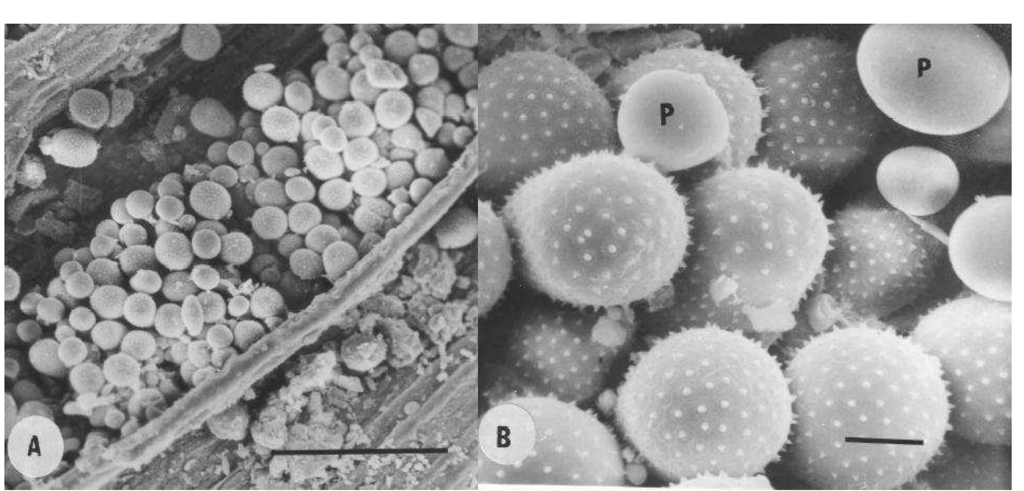Figure 4 - Morphology of uredinia and urediniospores of