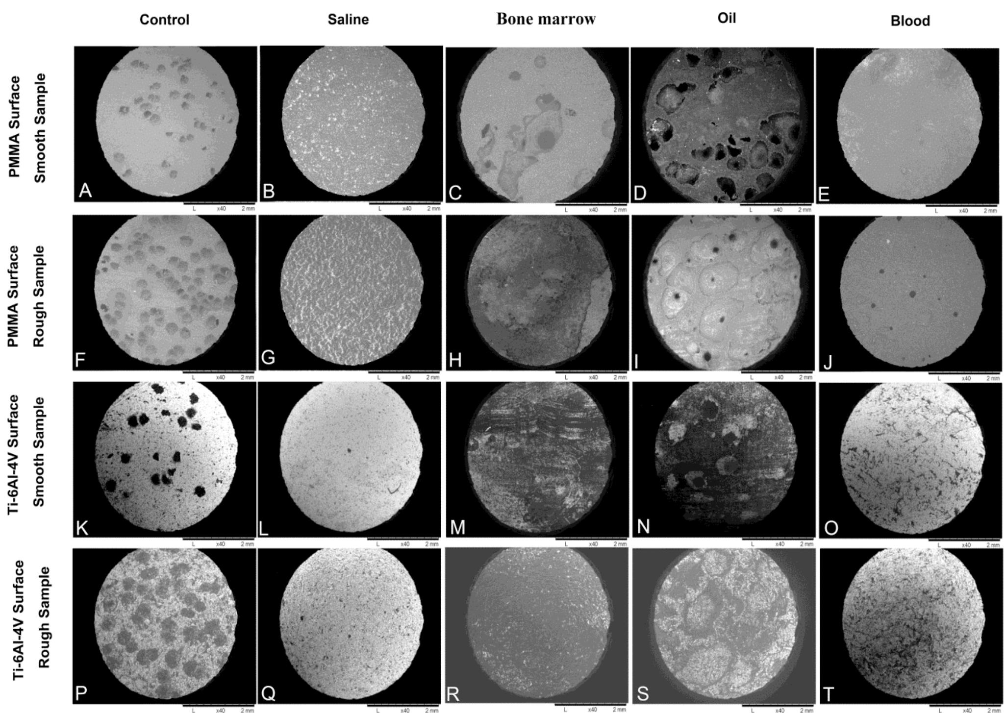 Figure 3 - from Cement-implant interface contamination: