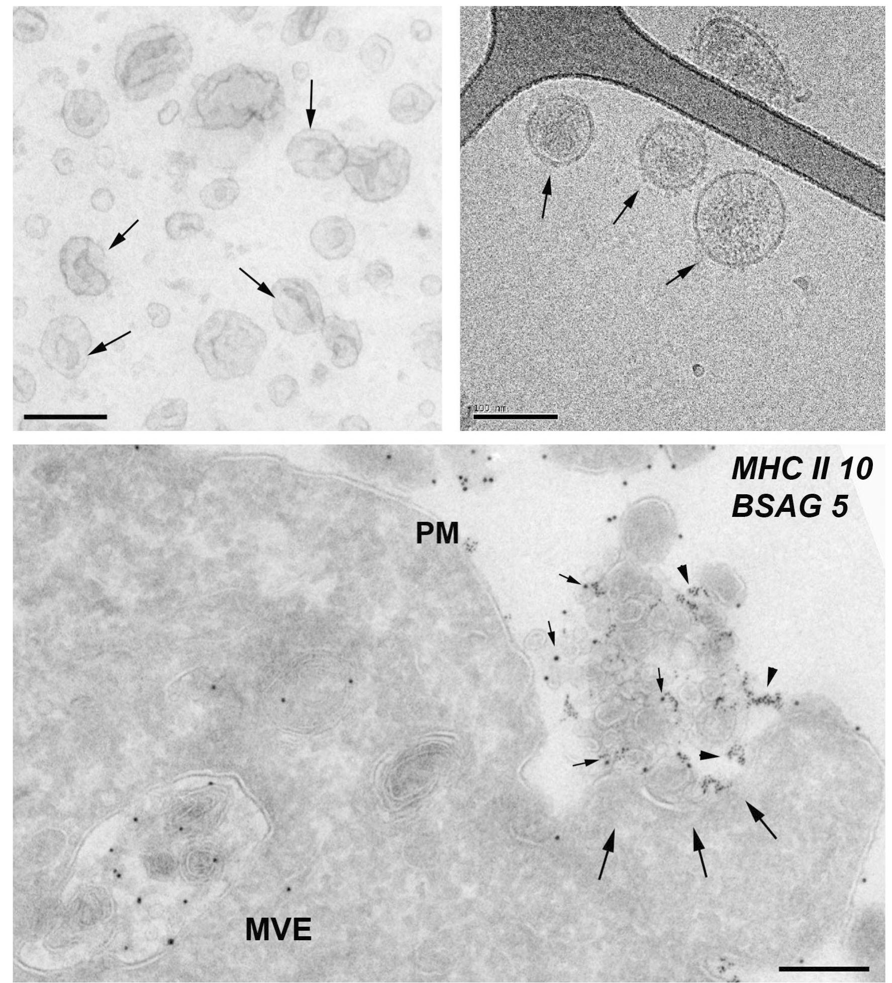 Ultrastructure of exosomes. (top left) exosomes isolated