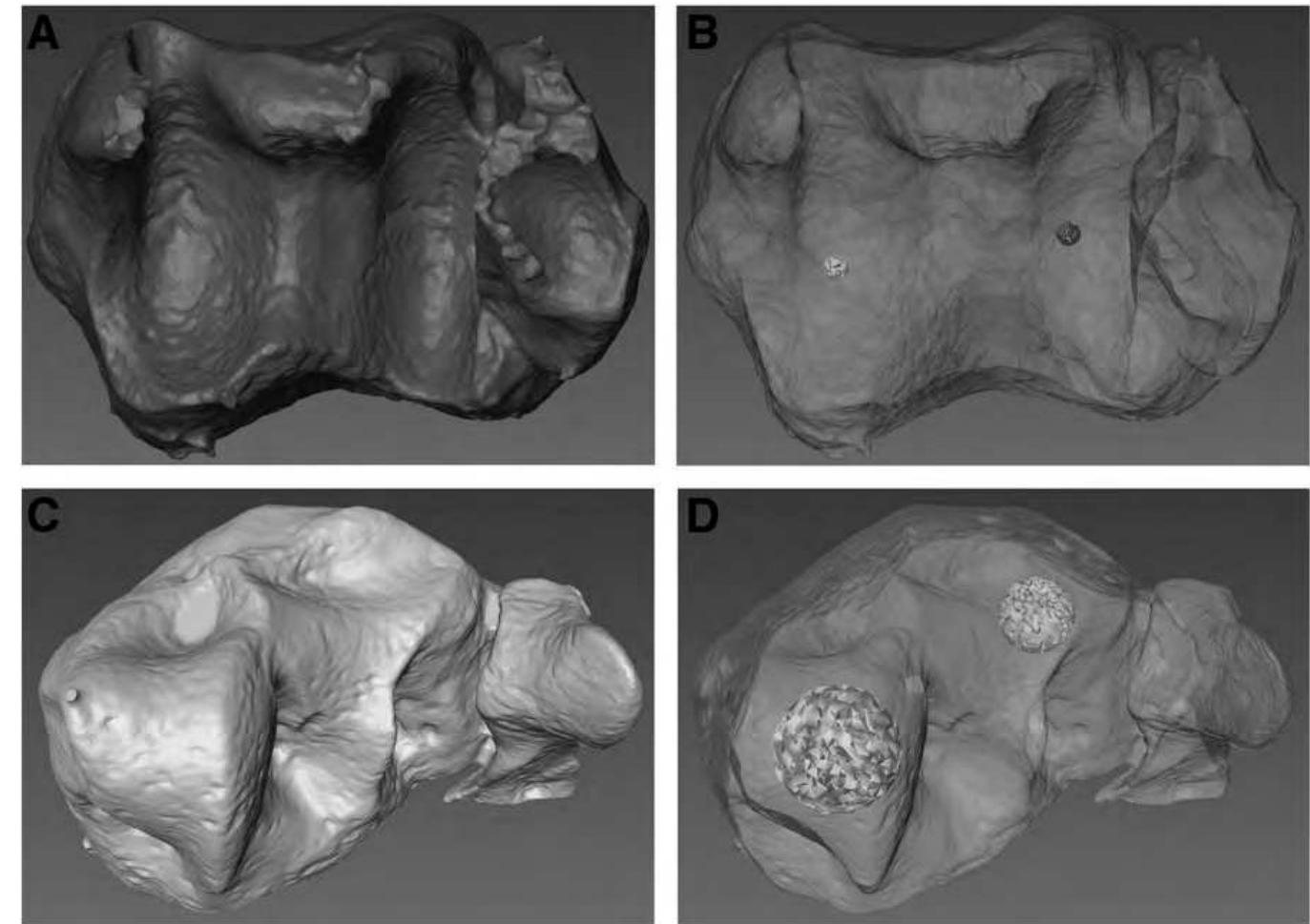 3d isosurfaces of a distal tibia (figs. 2a and b) and a
