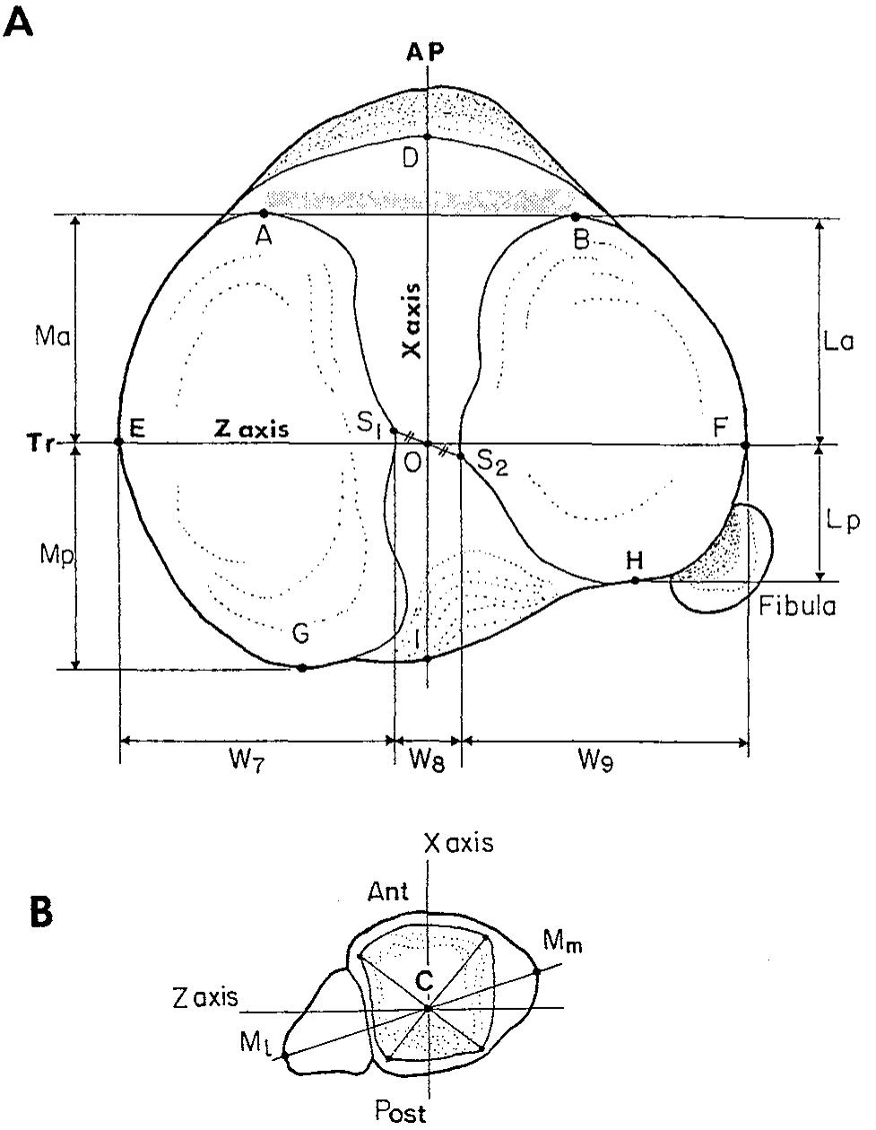 (a) contour of the tibial plateau (transverse plane) showing