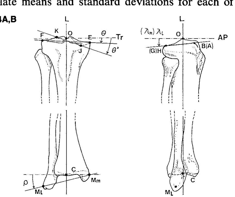 Sketches of the tibia and fibula in the frontal (a) and