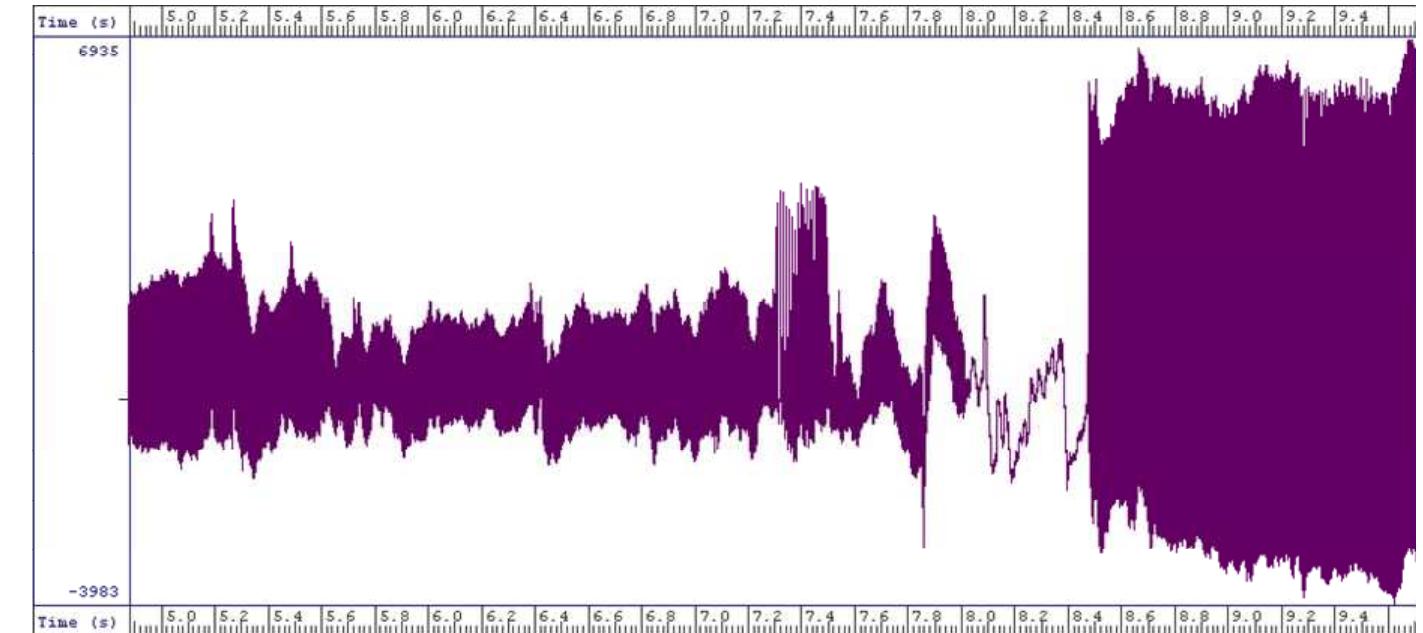 35 the lx waveform of boy h aged 13 years 10 months, singing
