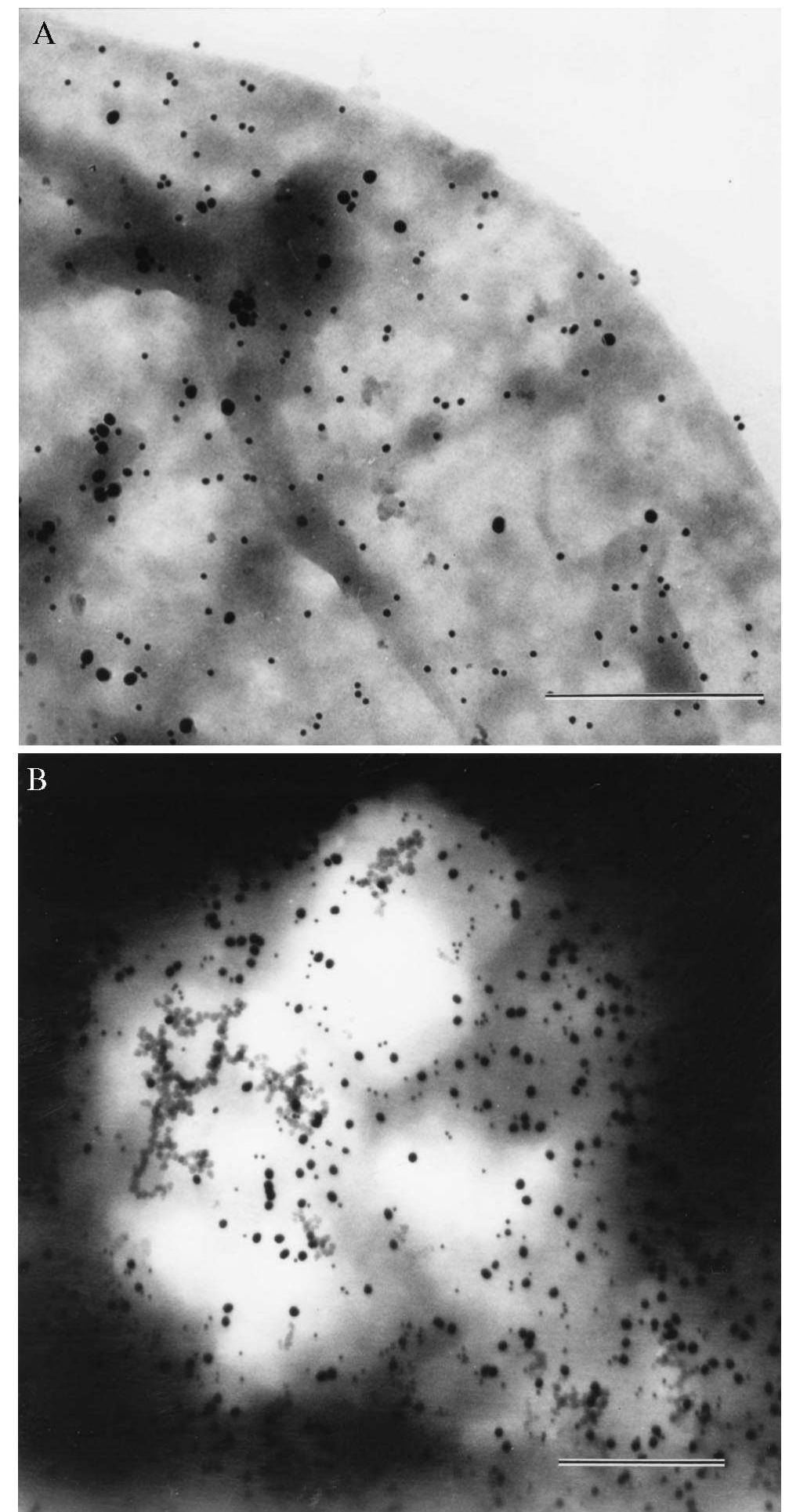 Fic. 2. tem images of immunogold labeled jy cells. labeling