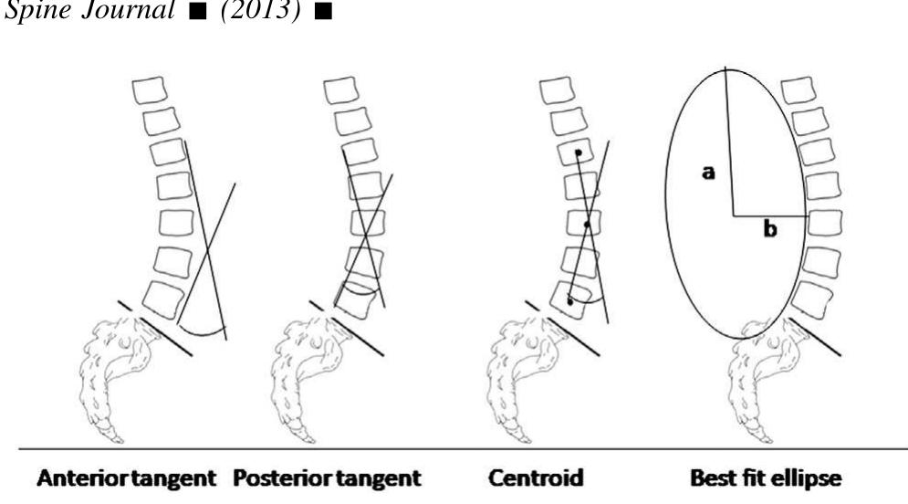 Measurements of lumbar lordosis: anterior tangent, posterior