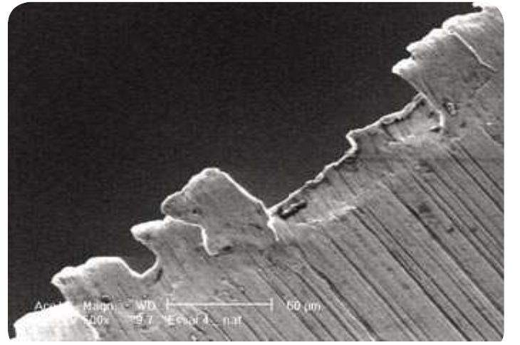 Figure 9 - Simplifying endodontics with EndoSequence rotary