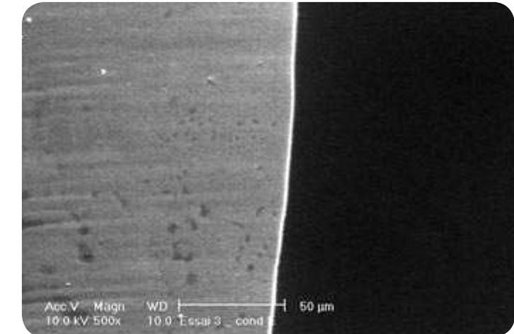 Figure 11 - Simplifying endodontics with EndoSequence rotary