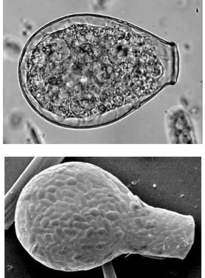 Figure 10 - Phylum Amoebozoa - amoebas, pelobionts, slime
