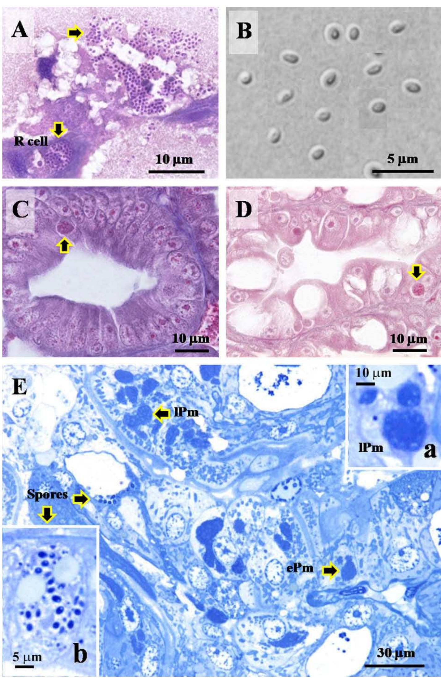 Photomicrographs of enterocytozoon hepatopenaei tubule