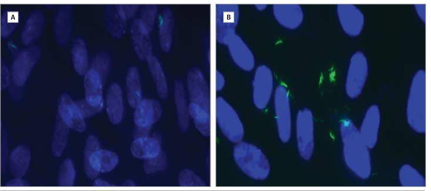 Intra-retinal pigment epithelium (rpe) mycobacteria