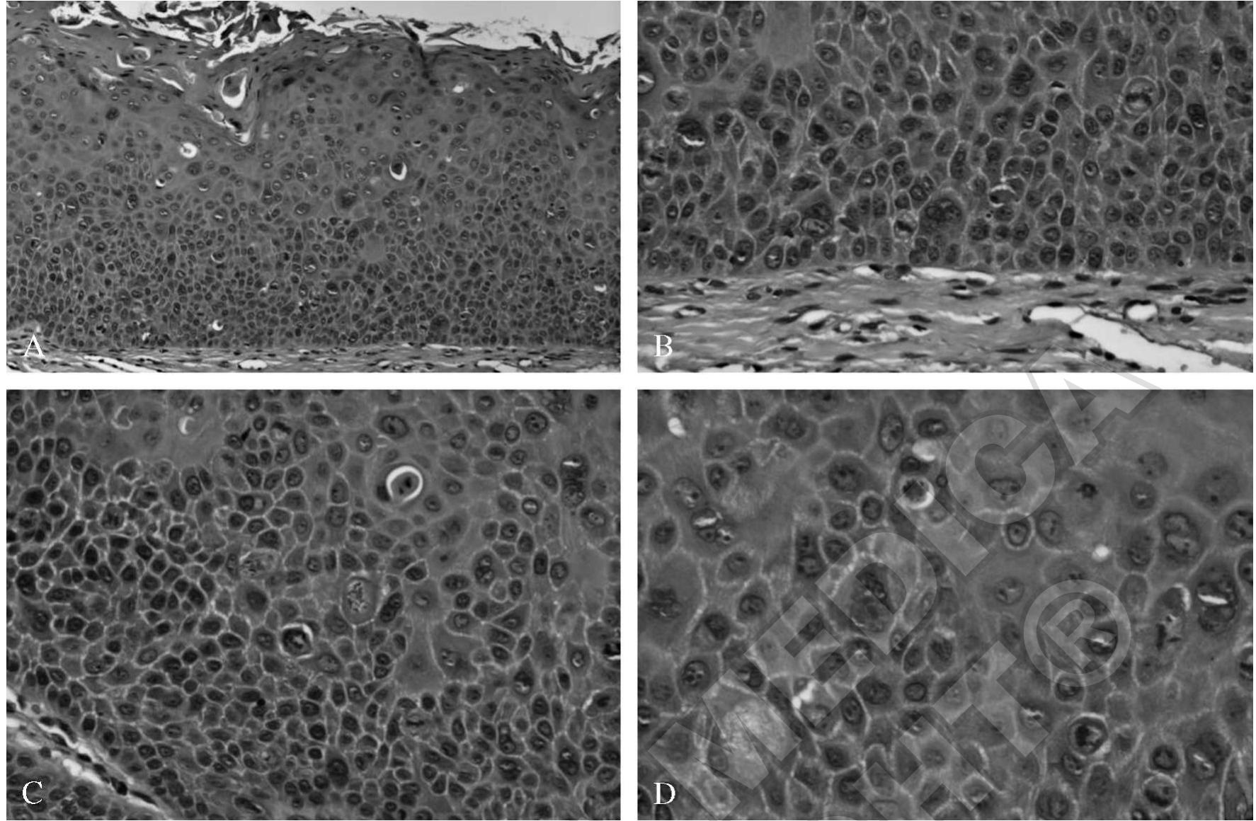 —stratified squamous epithelium histological slide