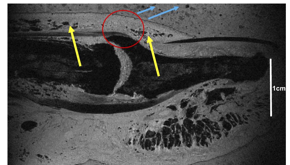 Female left middle finger. sagittal section showing the
