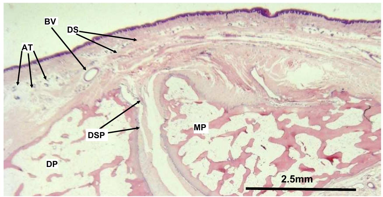 Right ring finger (hematoxylin and eosin stain;